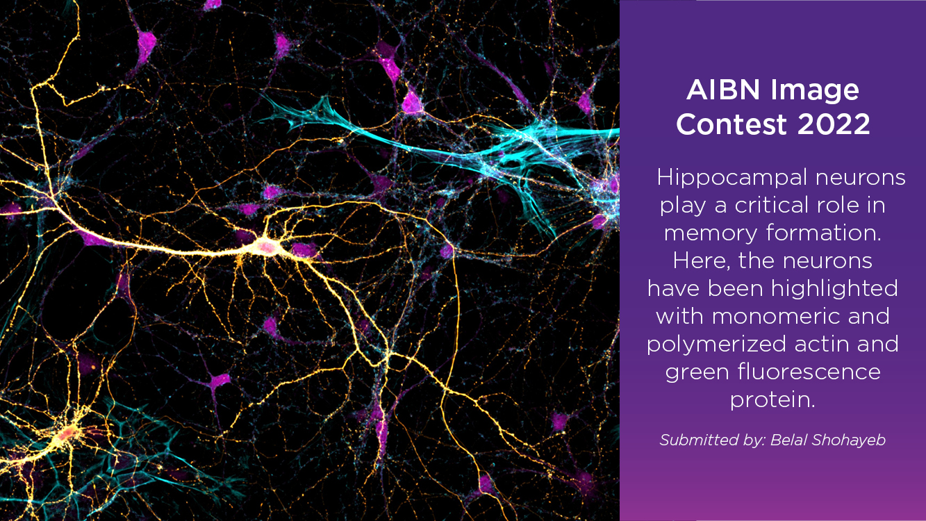 More to AIBN science than meets the eye - Australian Institute for Bioengineering and ...